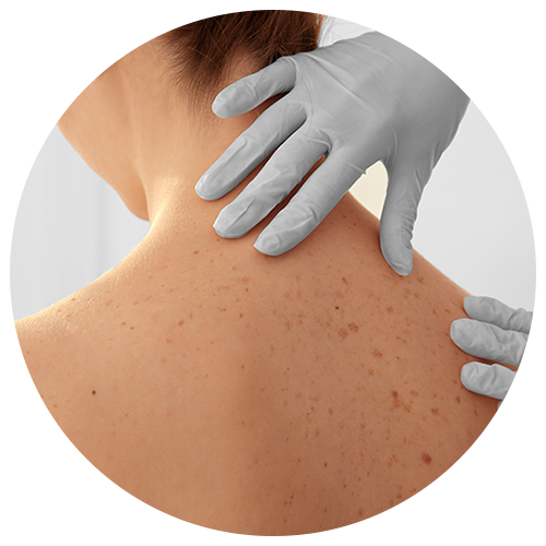 ePORE® Therapy | Precision Cancer Treatment Technology | Mirai Medical