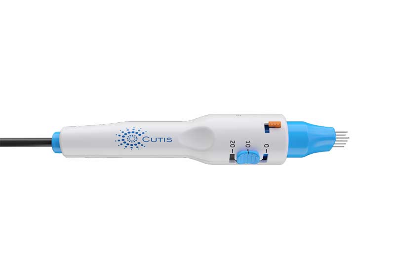 Mirai Medical | Cutis Electrode| Cutaneous Tumours